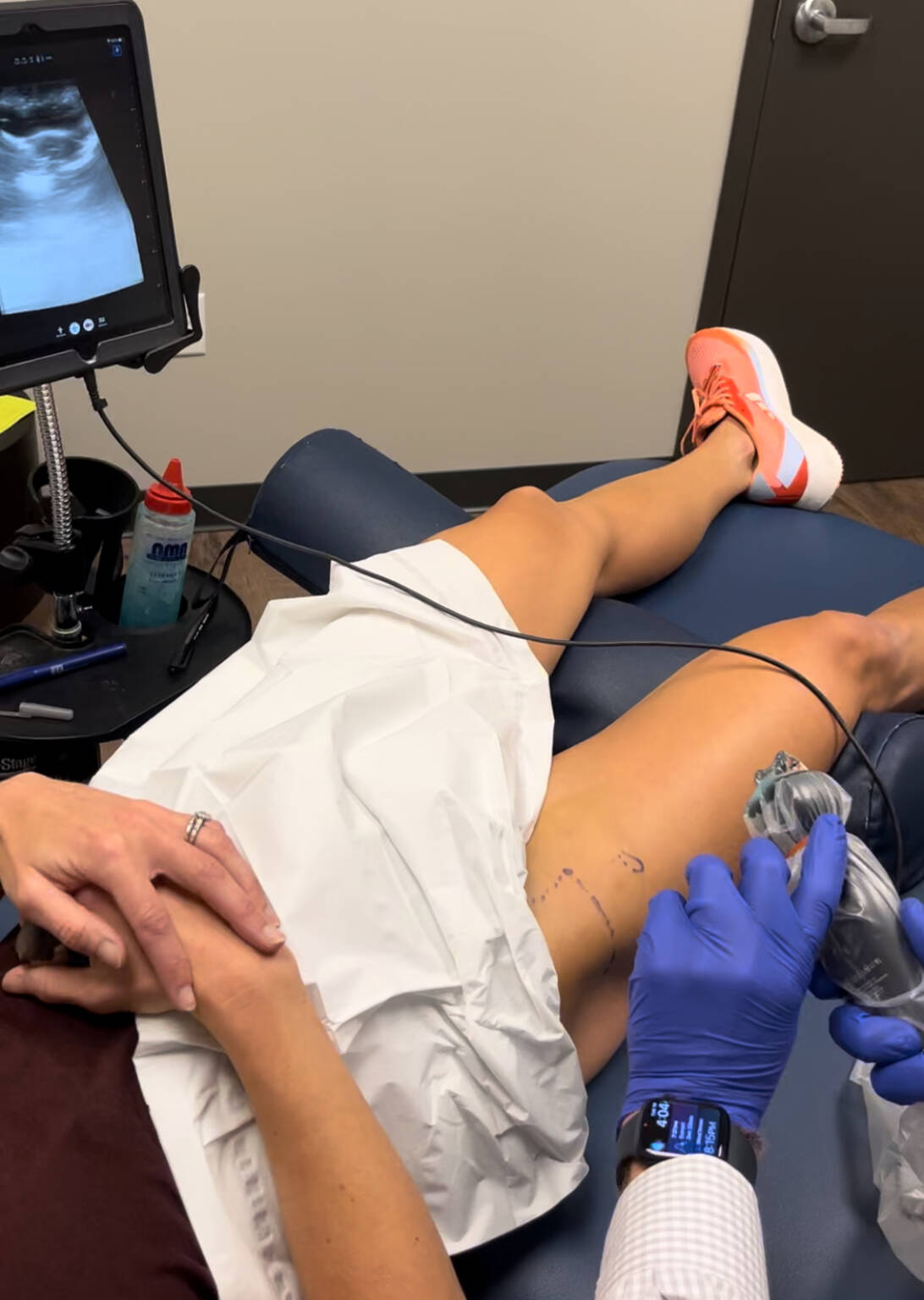 How Im Healing My Hip Labral Tear Without Surgery The Mother Runners